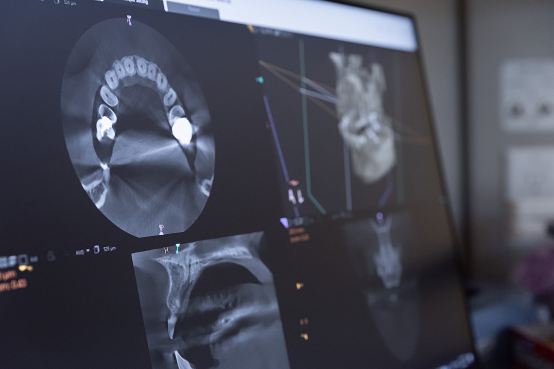 Endodontist Services | Rochester Endodontics, P.A